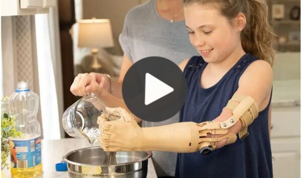 Unterstützung von Kriegsopfern mit 3D-Druck - 3Dnatives