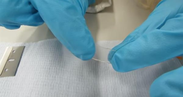 3D-gedrucktes Bioglas könnte für Knorpelimplantate verwendet werden ...