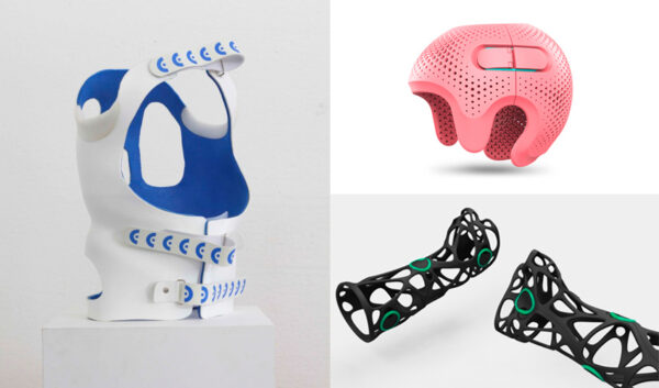 Top 3D Printed Orthoses - 3Dnatives