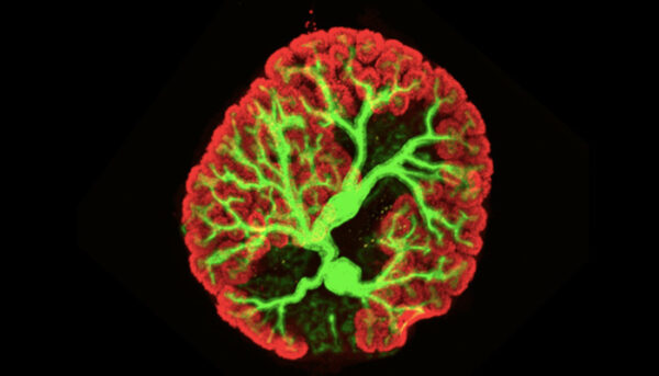 3D Printed Organs: The Top Viable Projects - 3Dnatives