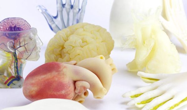 3D printed anatomical models transform surgical planning - 3Dnatives