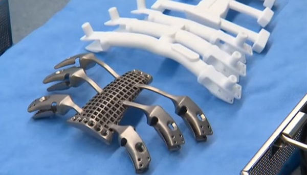 UNSW Scientists use new bioink to create 3D printed bone - 3Dnatives