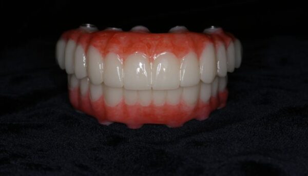 Navy Sailors Receive 3D Printed Dental Prosthetics - 3Dnatives