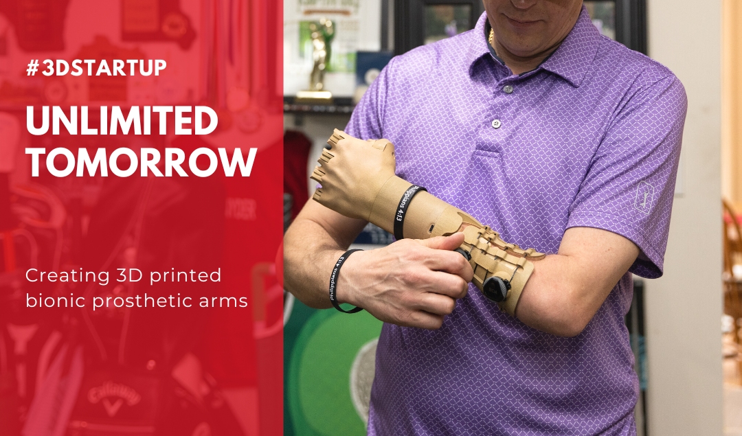 #3DStartup: Unlimited Tomorrow and its 3D Printed Bionic Prosthetic Arm ...