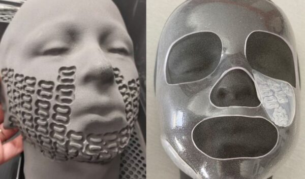 3D Printing is Being Used to Treat Children With Severe Burns - 3Dnatives