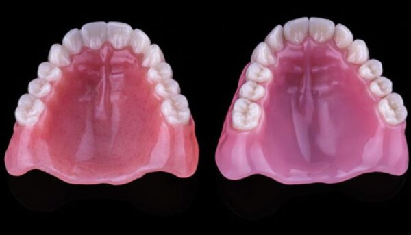 The Top 3D Printing Applications in Dentistry - 3Dnatives