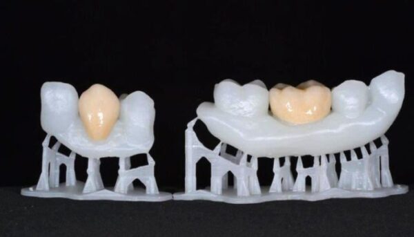 The Top 3D Printing Applications in Dentistry - 3Dnatives
