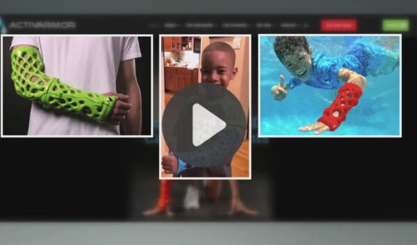Top 5 Videos: The First Patient in Louisiana Receives a 3D Printed ...