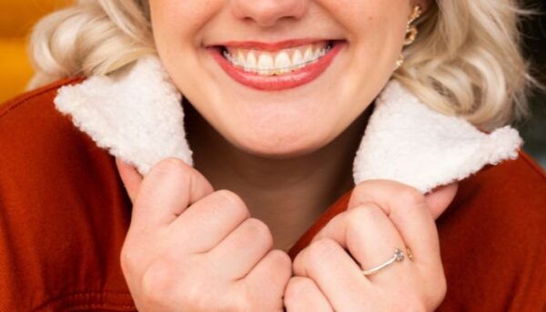 LightForce Orthodontics Gets $80M Funding for 3D Printed Braces - 3Dnatives