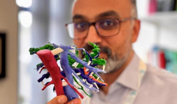 3D Printed Tumor Models Enhance Surgery Precision - 3Dnatives