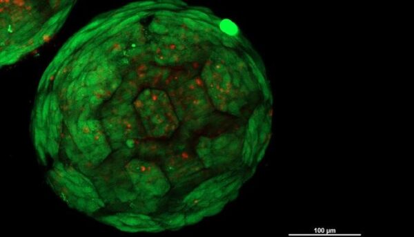 It Is Now Possible to 3D Print Artificial Cartilage for Living Tissue ...