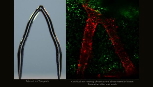 3D Ice Printing Can Create Artificial Blood Vessels in Breakthrough for ...