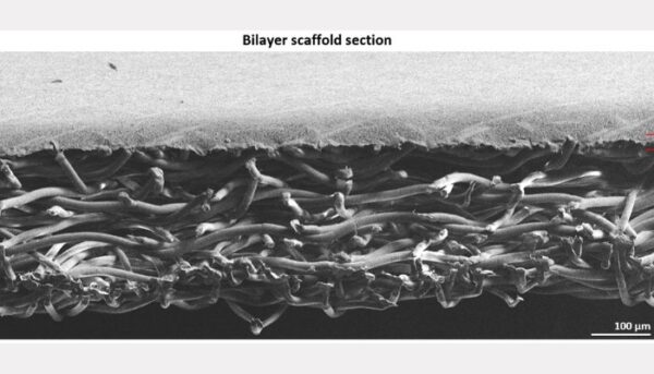 L'Oréal 3D Prints Human Skin in Partnership With University of Oregon ...