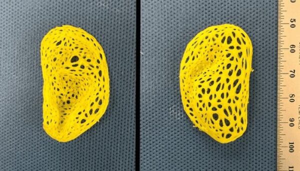 Cornell Revolutionizes Realistic Ear Grafts With 3D Printed Ear - 3Dnatives