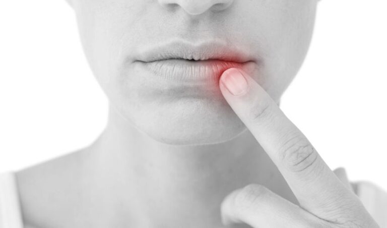 3D Printed Human Skin Equivalents Help Identify Potential HSV ...