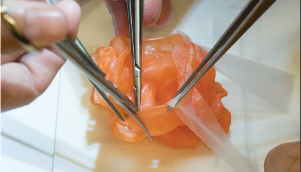 3D Printing Is Revolutionizing Surgical Planning, and It's Only the ...