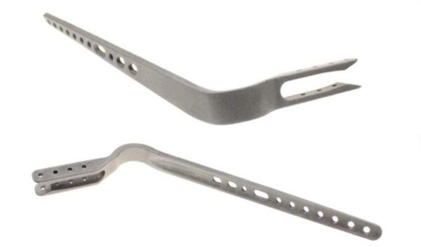 Application of the Month: Customized 3D-Printed Titanium Shoulder Arthrodesis Plates - 3Dnatives