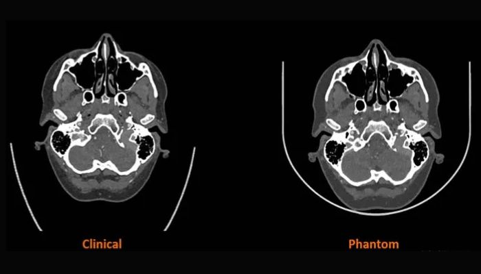 Stratasys Expands Availability of RadioMatrix™ Radiopaque Material to ...