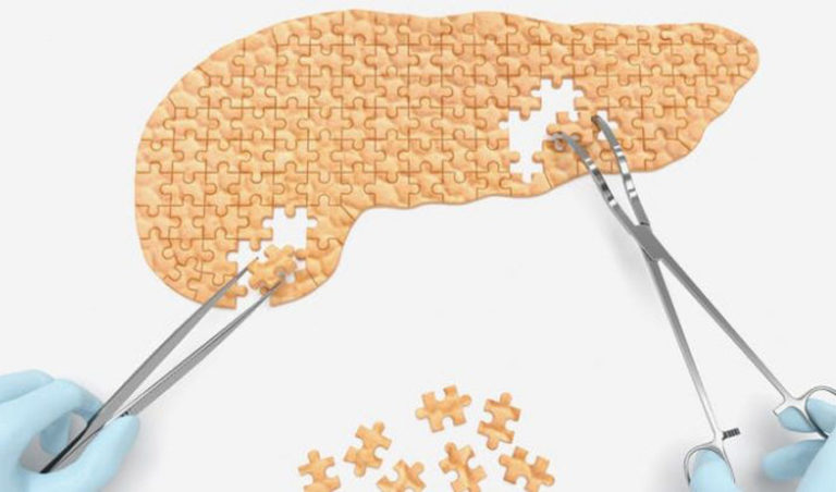 3D Bioprinted Bionic Pancreas to Fight Diabetes - 3Dnatives