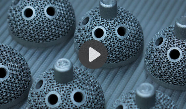 Top 5 Videos: 3D printed orthopaedic implants - 3Dnatives