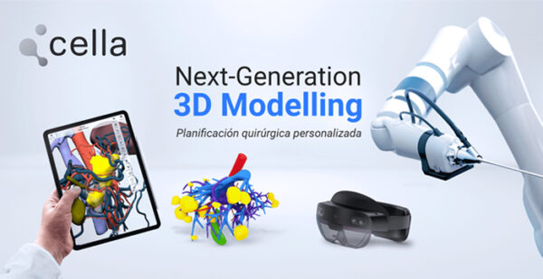 Cella y el uso de las tecnologías 3D en la planificación quirúrgica ...