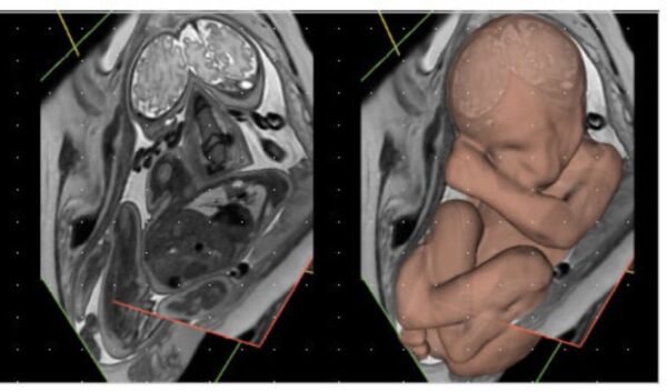 Reconstruyen un útero materno en 3D en la UPM - 3Dnatives