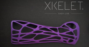 Startup del mes: Xkelet, la inmovilización personalizada - 3Dnatives