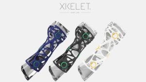 Startup del mes: Xkelet, la inmovilización personalizada - 3Dnatives