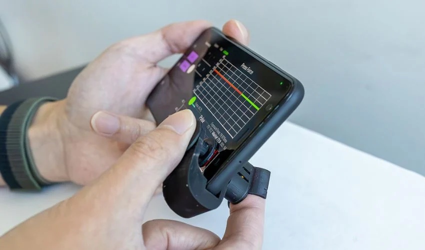 Revolutionary 3D Printed Smartphone Accessory For Blood Pressure